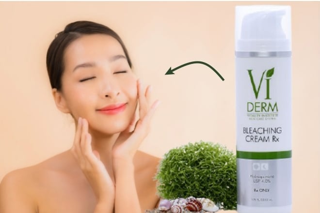 Kem trị nám Viderm Bleaching Cream được "săn đón” có hiệu quả không?
